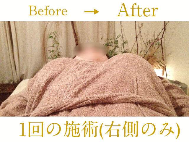 美容矯正 | Rananda 女性専用アロママッサージ - Rananda 女性専用アロママッサージ